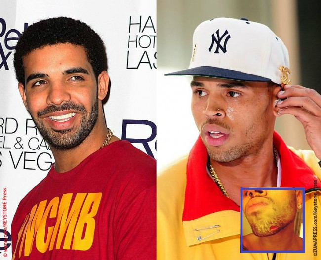 Chris Brown injured in bar fight with Drake « Celebrity Gossip and ...