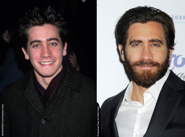 Jake Gyllenhaal Nose Job